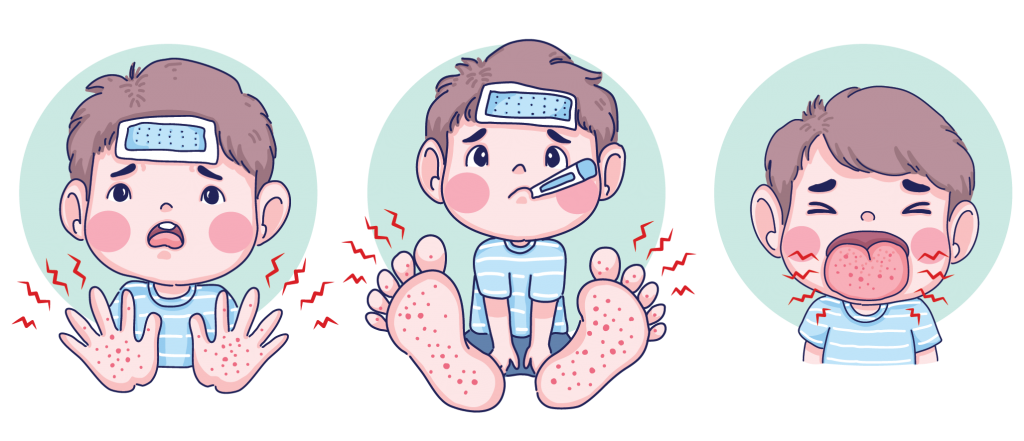 An Insight into Hand, Foot and Mouth Disease (HFMD) - BabyTalk - Baby ...